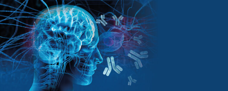 NEUROMIELITIS OPTICA – MANLAB